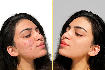 Photo Retouch – Background Removal